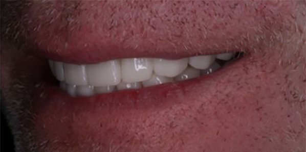 Ueckert Dentistry - Ueckert Dentistry