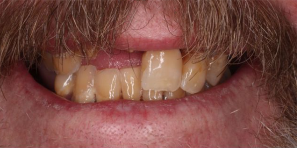 Ueckert Dentistry - Ueckert Dentistry