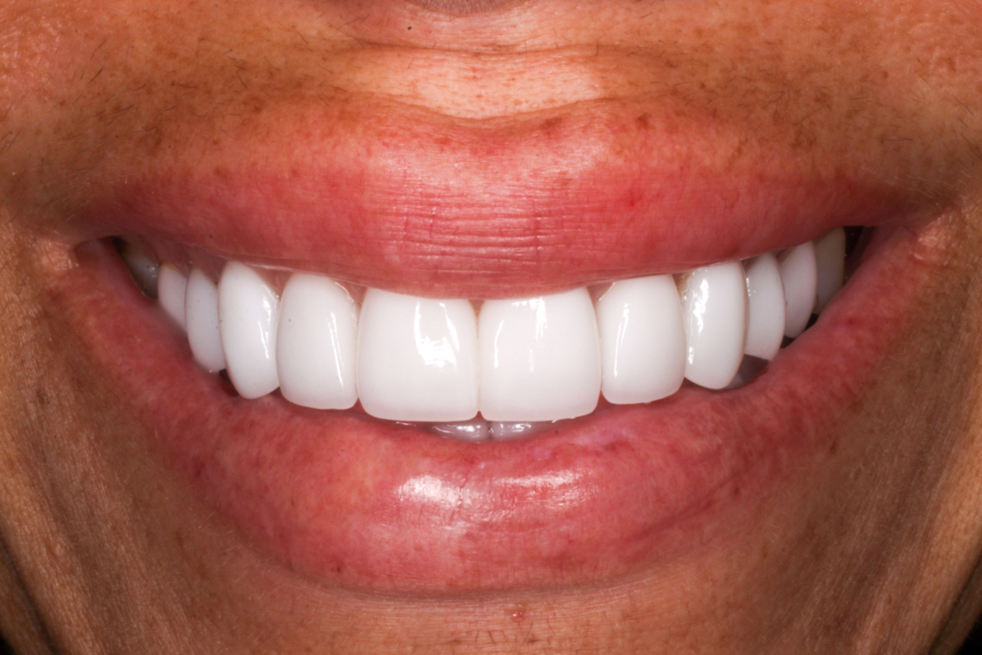 Ueckert Dentistry - Ueckert Dentistry