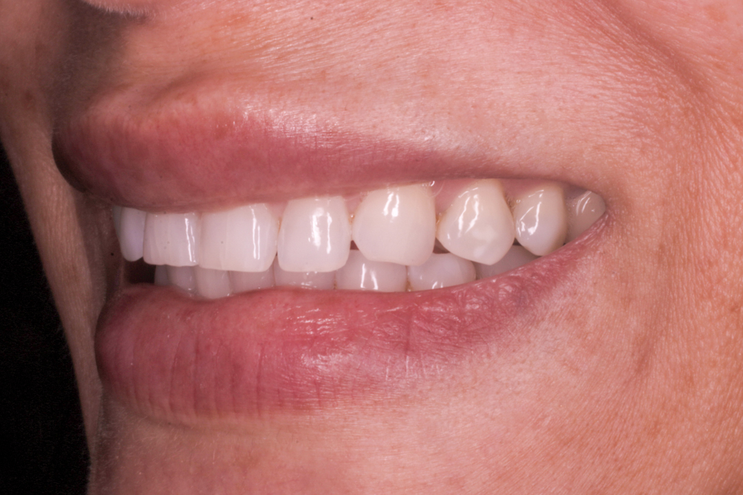 Ueckert Dentistry - Ueckert Dentistry