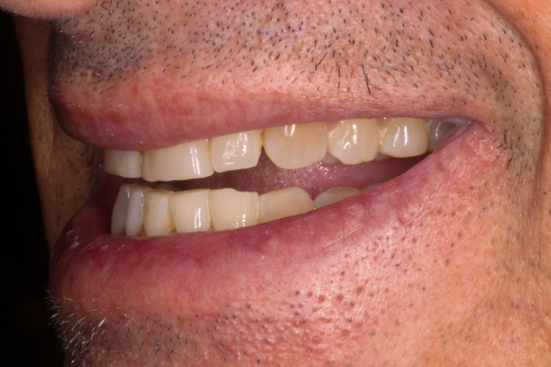 Ueckert Dentistry - Ueckert Dentistry