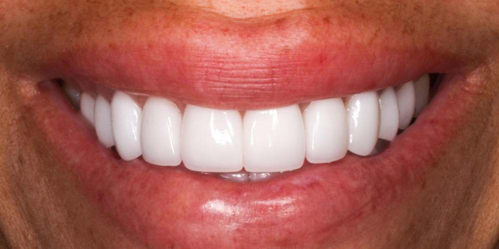 Ueckert Dentistry - Ueckert Dentistry