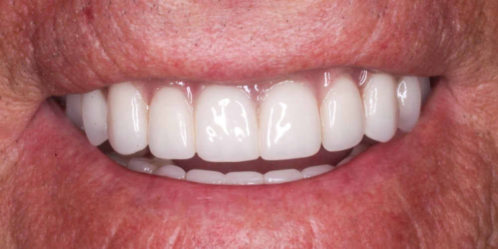 Ueckert Dentistry - Ueckert Dentistry