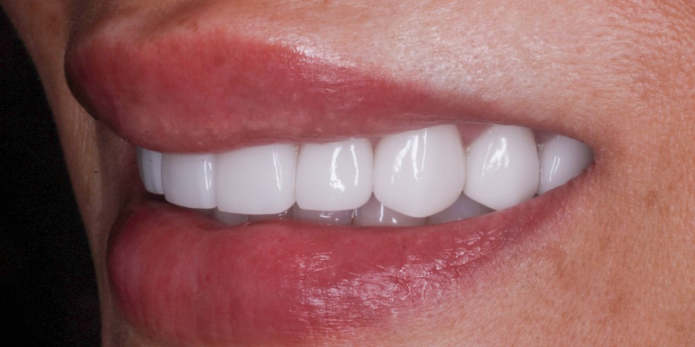 Ueckert Dentistry - Ueckert Dentistry