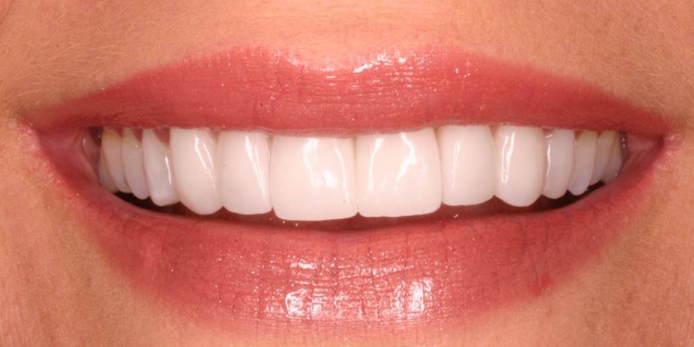 Ueckert Dentistry - Ueckert Dentistry